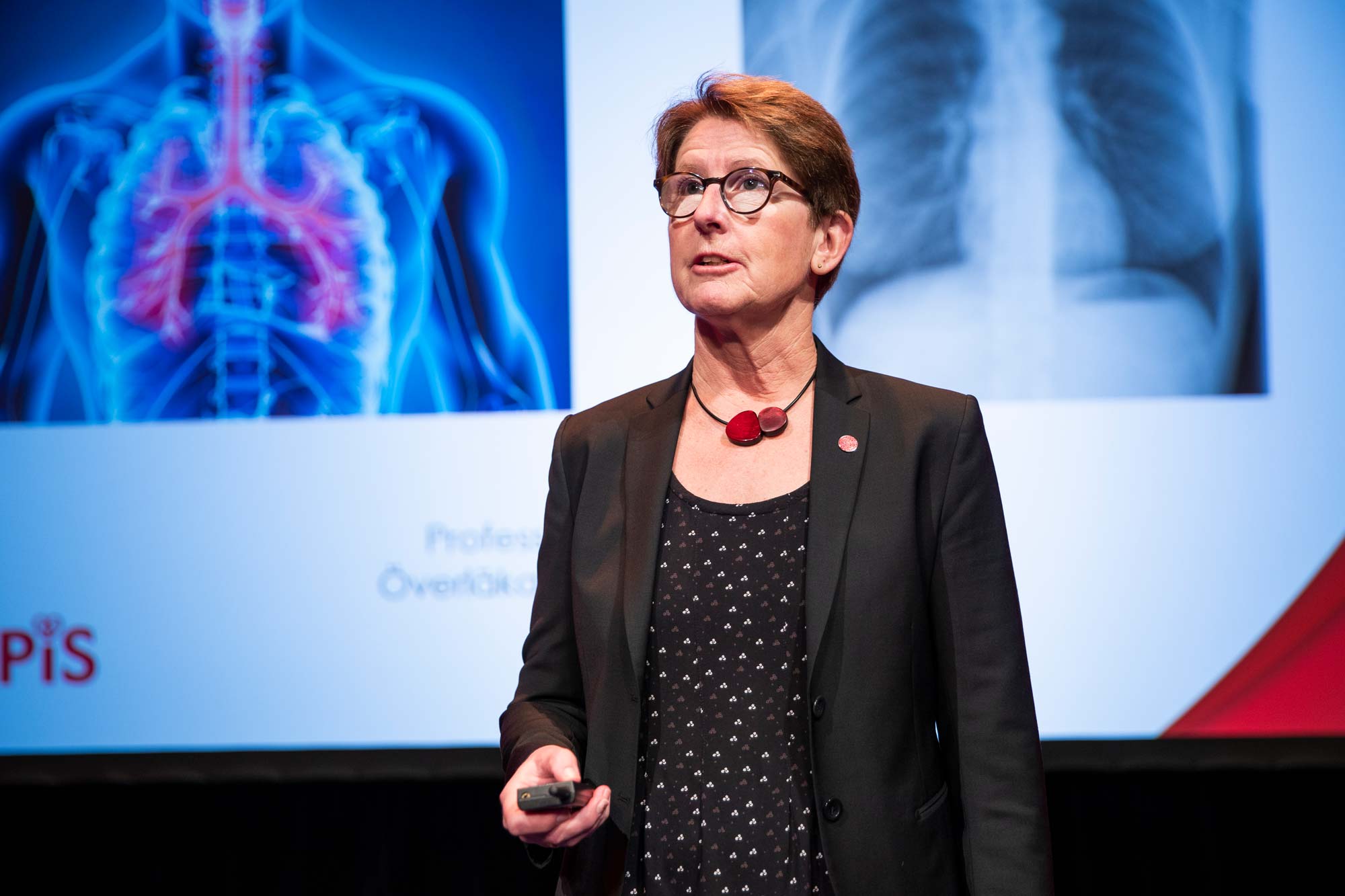 ANNONS: Professorn varnar: Obehandlad sömnapné kan leda till hjärt ...